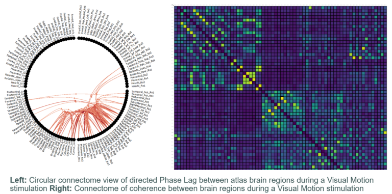 BESA® | Brain Electrical Source Analysis: BESA Connectivity > Overview