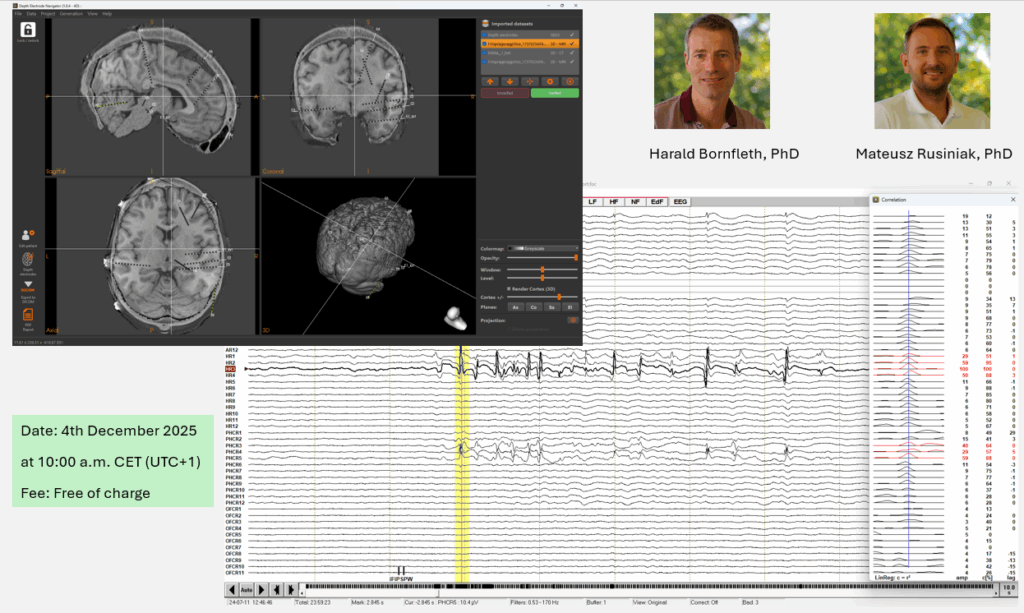 BESA® | Brain Electrical Source Analysis: Webinars > Webinar on sEEG ...