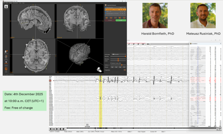BESA® | Brain Electrical Source Analysis: Webinars > Webinar on sEEG ...